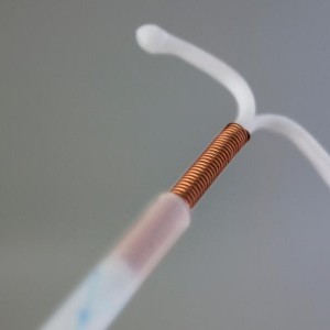 DIU: VEJA COMO FUNCIONA O IMPLANTE DO DIU