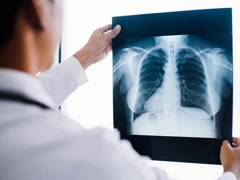 Exame de Raio-X de Tórax em Belém e Ananindeua - Clínica Rede Mais Saúde